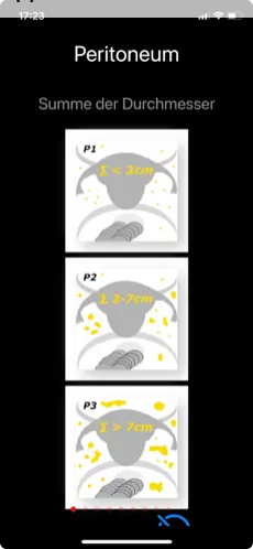 #Enzian Score – Medarus – providing Apps for clinicians